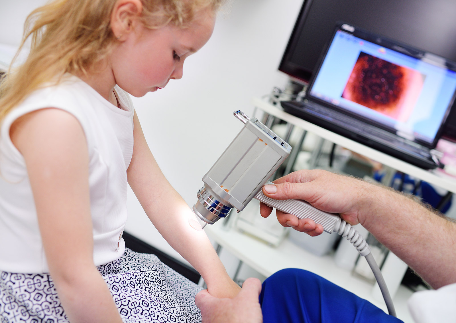 Tratamiento de Dermatoscopia digital (FotoFinder) en Murcia